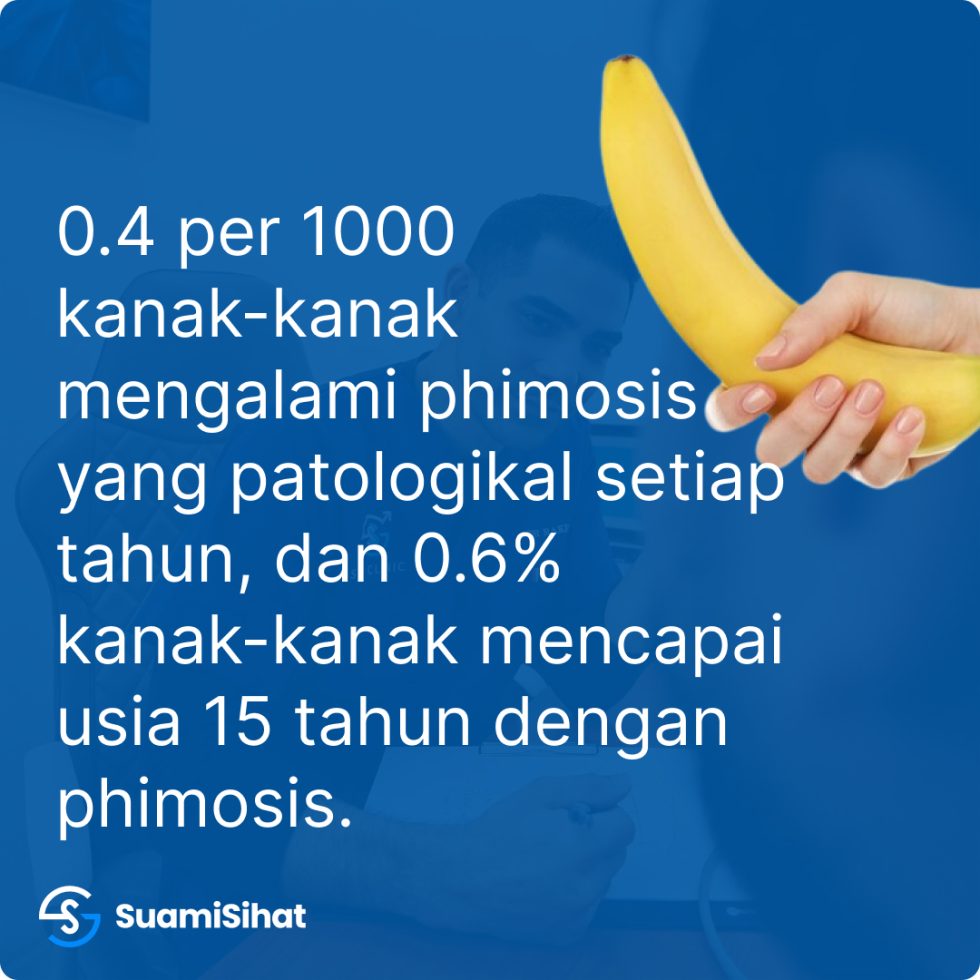 Zakar Buta (Phimosis) : Punca, Risiko & Cara Rawatan Moden